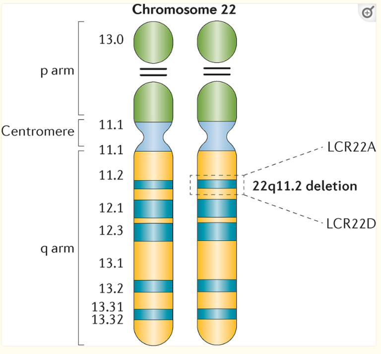 22q11.2 Deletion Syndrome: A Common and Complex Condition - This Week ...